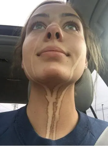 Mystic HD Sunless Tanning – Tropical Tan