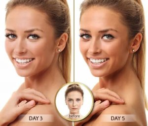 Versa Spa Pro – Tropical Tan